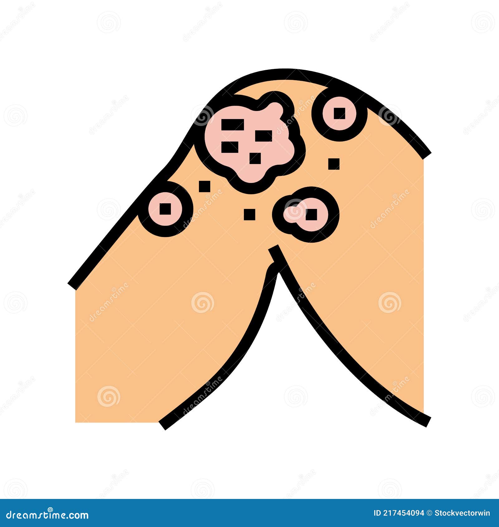 Atopic Dermatitis Color Icon Vector Illustration Stock Vector