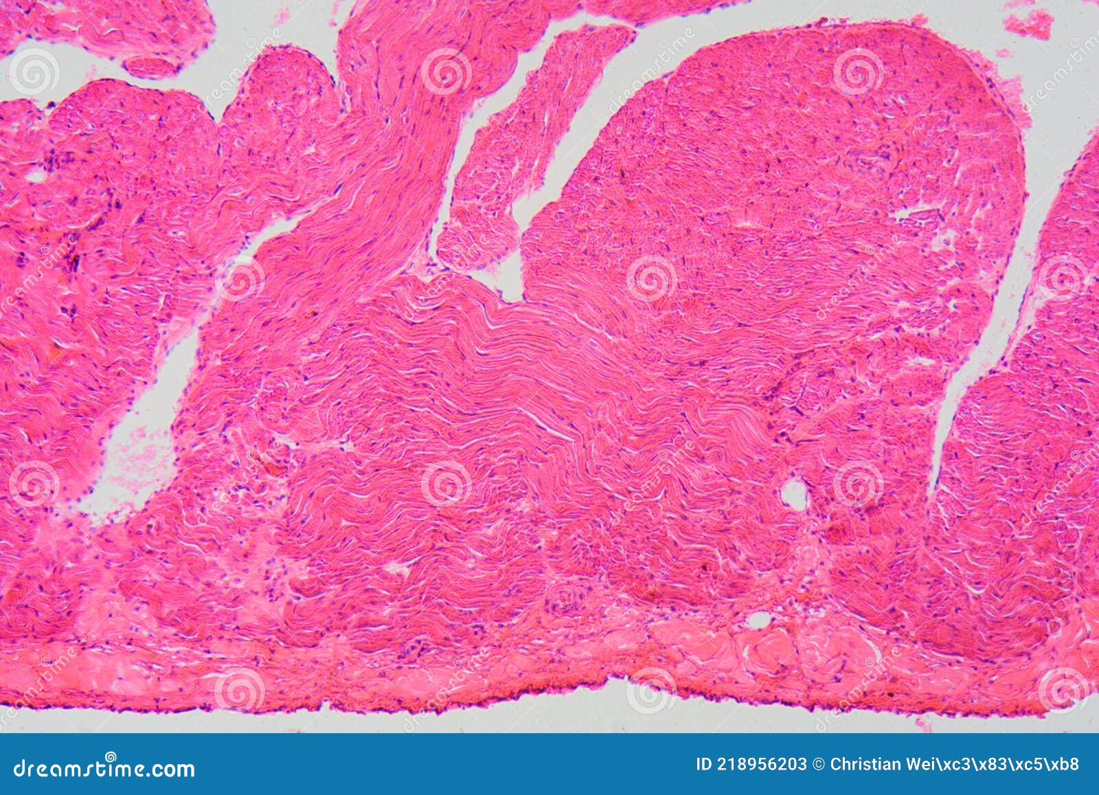 Atrial Wall of a Human Heart in the Microscope Stock Image - Image of ...