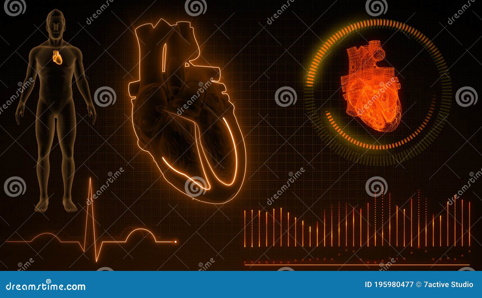 AV Node Signal or Atrioventricular Node Signal of Human Heart Stock ...