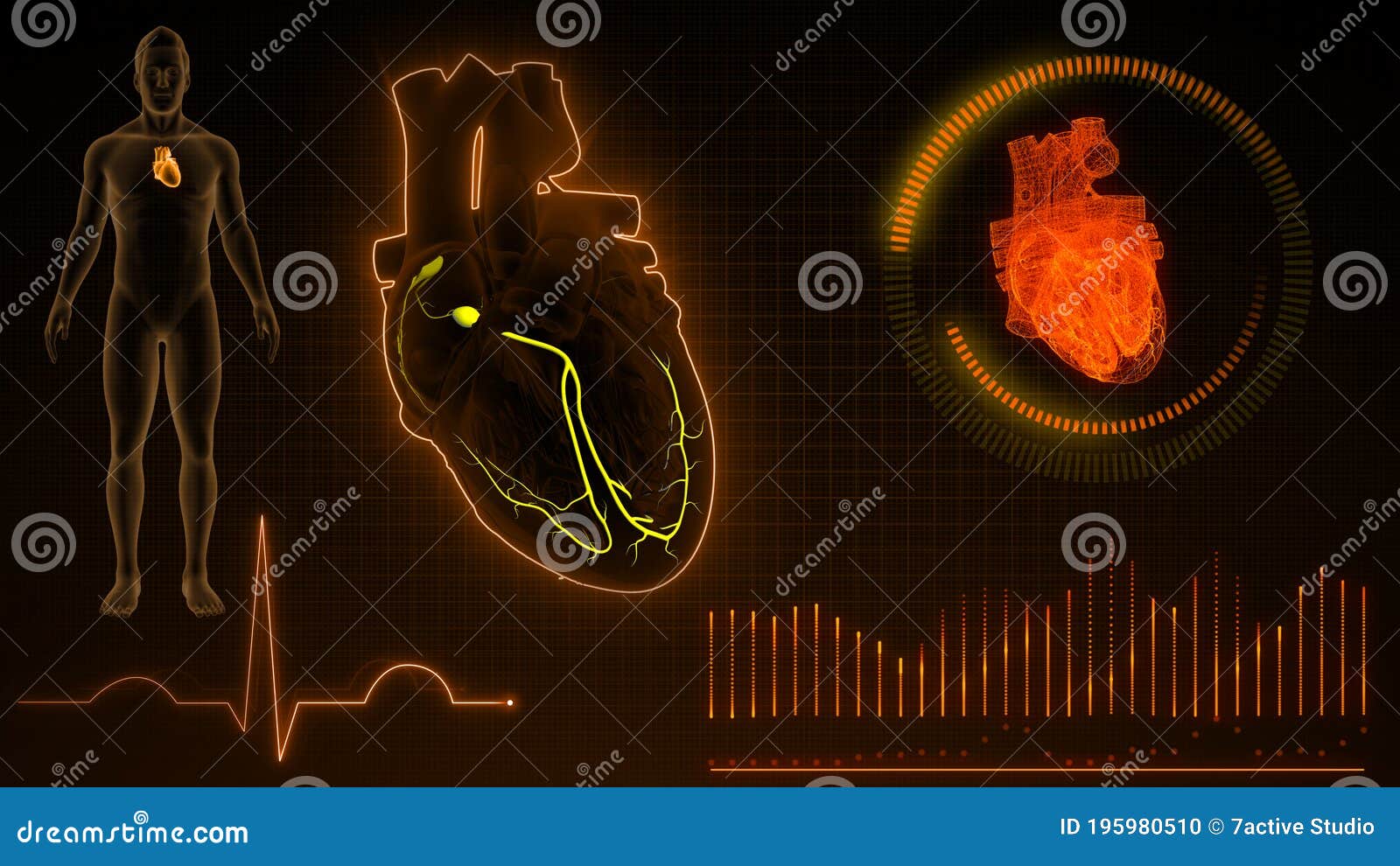AV and SA Node Signals or Atrioventricular and Sinoartial Node Signal ...