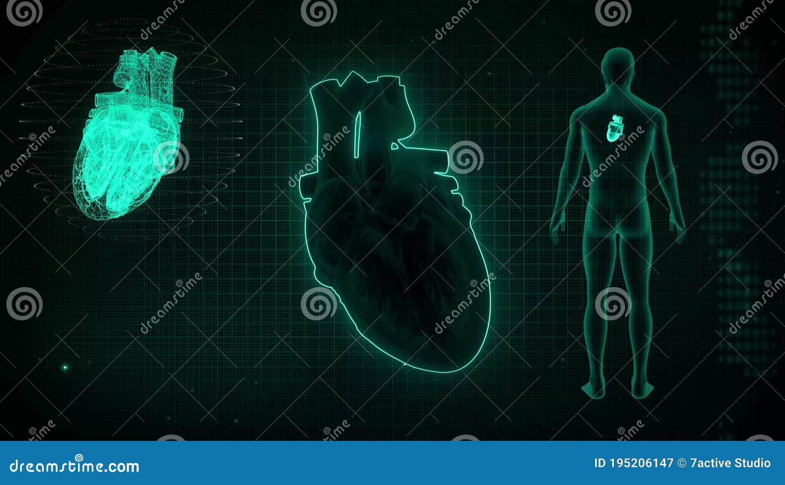 AV Node Signal or Atrioventricular Node Signal of Human Heart Stock ...