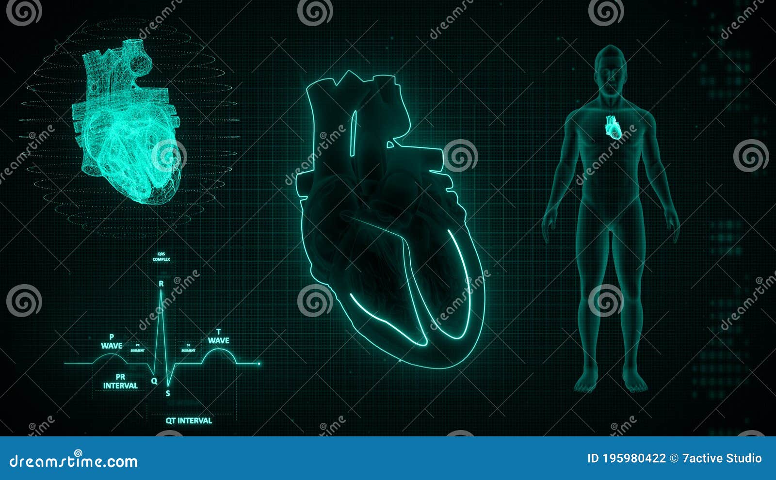AV Node Signal or Atrioventricular Node Signal of Human Heart Stock ...