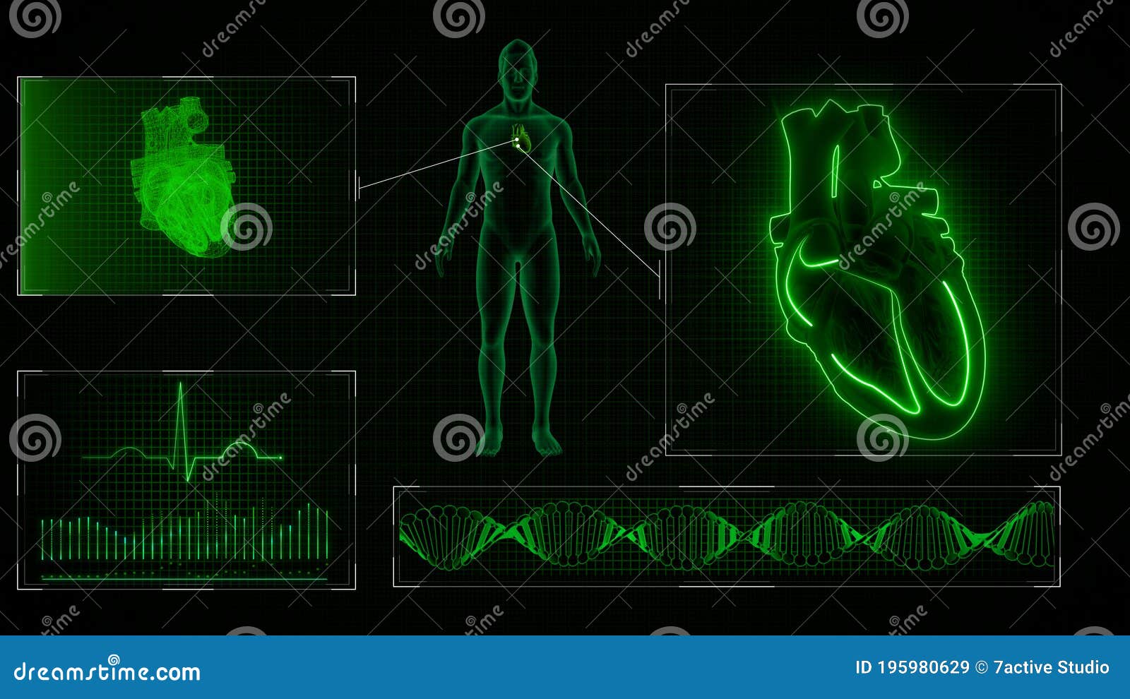 AV and SA Node Signals or Atrioventricular and Sinoartial Node Signal ...
