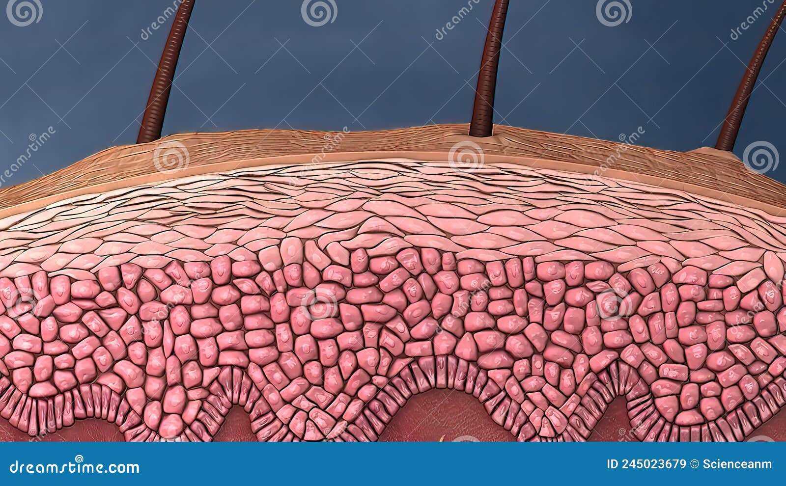 The Attack of Airborne Bacteria on the Skin Wound and the Activation of ...