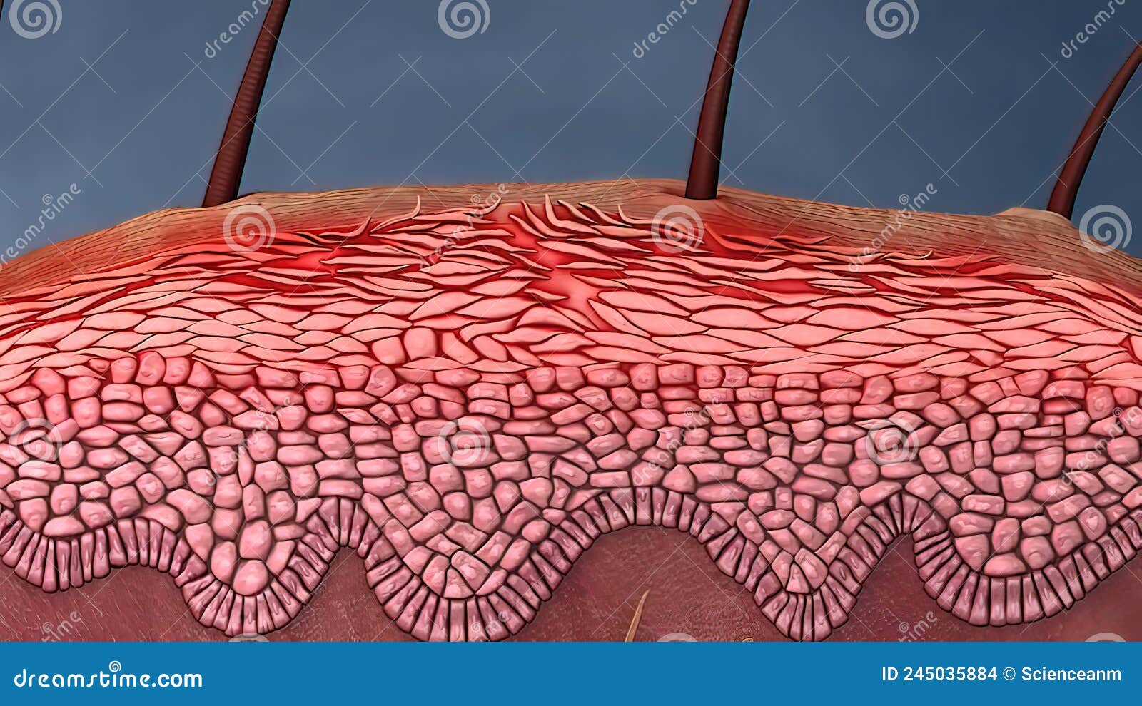 The Attack of Airborne Bacteria on the Skin Wound and the Activation of ...