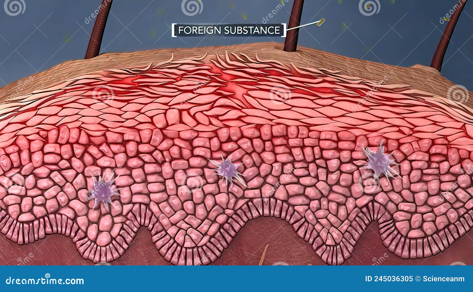The Attack of Airborne Bacteria on the Skin Wound and the Activation of ...