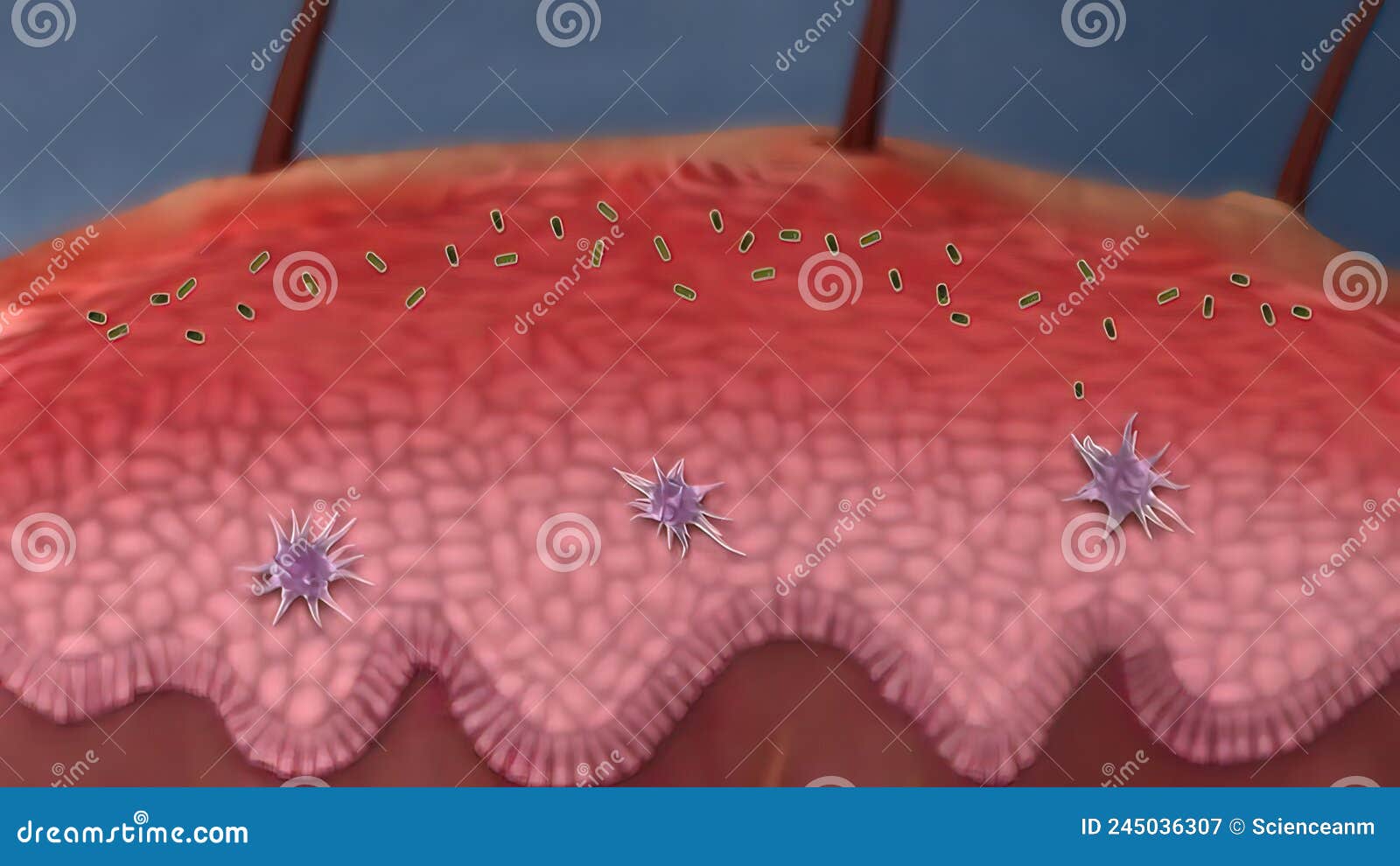The Attack of Airborne Bacteria on the Skin Wound and the Activation of ...