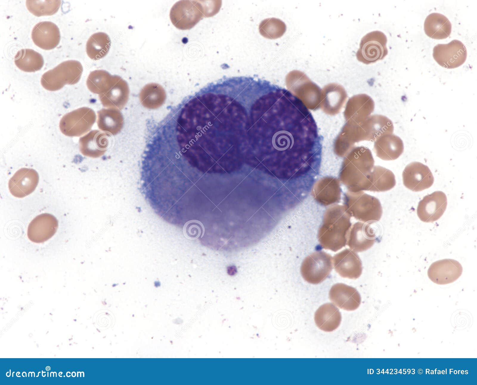 Megakaryocyte Is A Large Bone Marrow Cell That Produces Blood Platelets ...