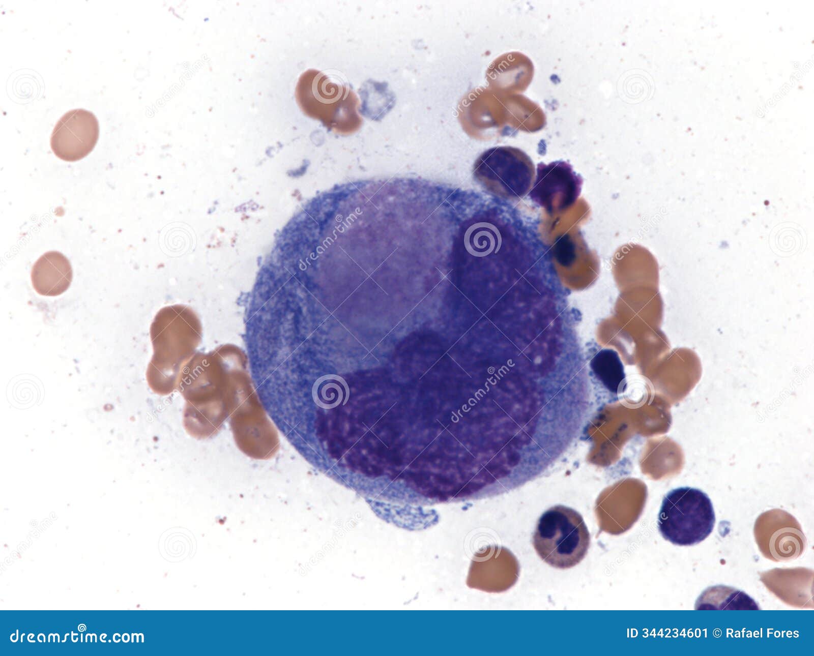 Megakaryocyte Is A Large Bone Marrow Cell That Produces Blood Platelets ...