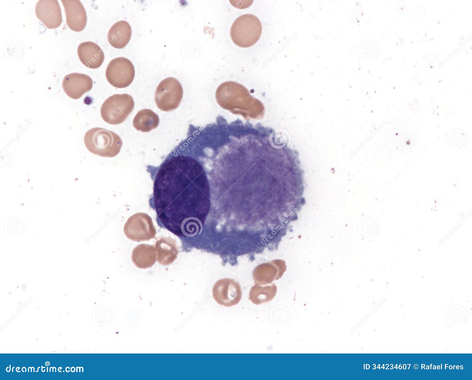 Megakaryocyte Is A Large Bone Marrow Cell That Produces Blood Platelets ...