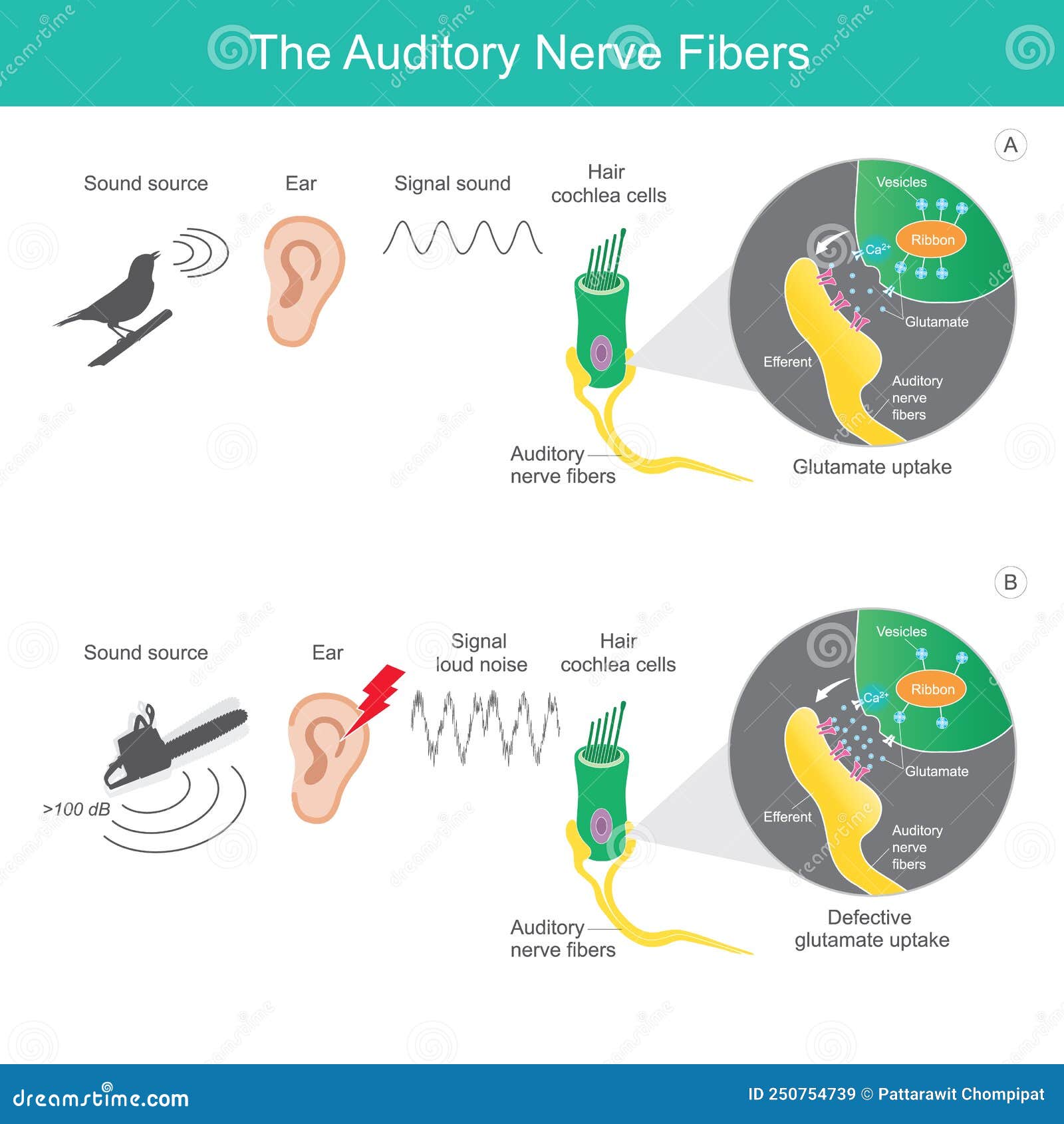 The Auditory Nerve Fibres, Comparison Sound Source 2 Types Which it is ...