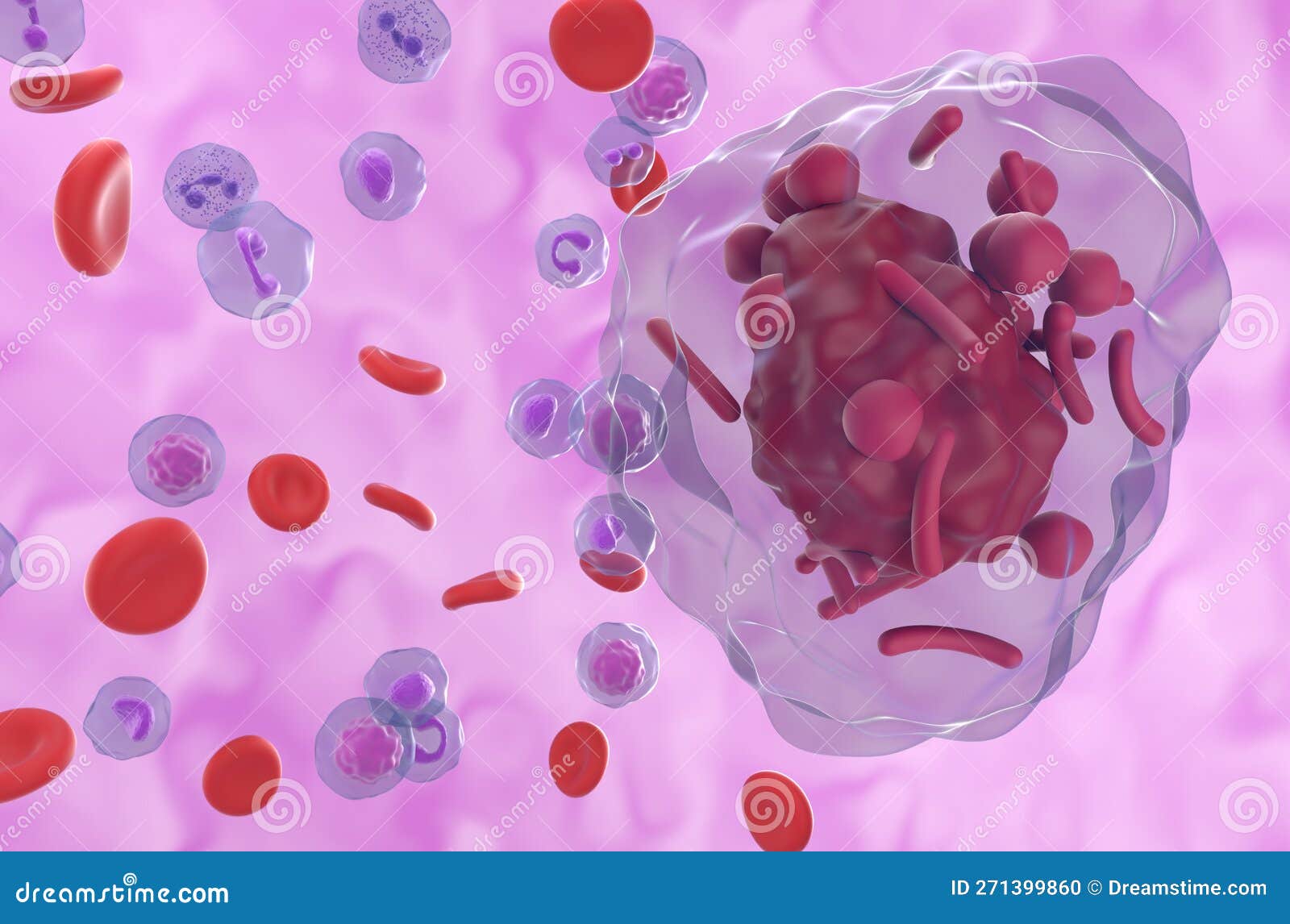 Auer Rods (or Auer Bodies) In Acute Hypergranular Promyelocytic ... Auer Rods (or Auer Bodies) In Acute Hypergranular Promyelocytic ...