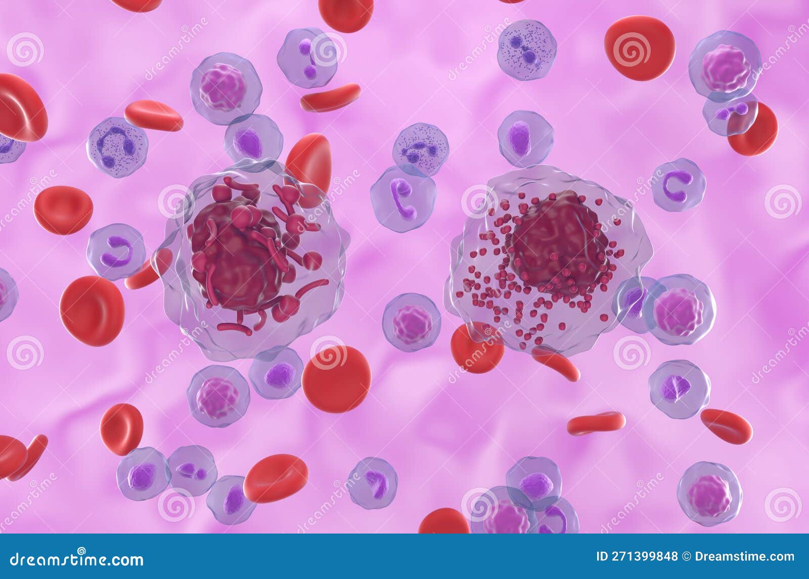 Acute Promyelocytic Leukemia Cells Or APL Royalty-Free Stock Photo ... Acute Promyelocytic Leukemia Cells Or APL Royalty-Free Stock Photo ...