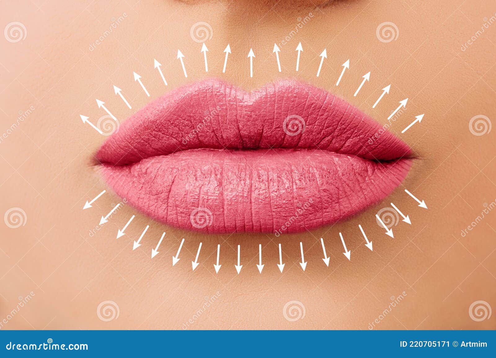 Aumento Labial. Rellenos. Hermosos Labios Rosas Perfectos Imagen de ...