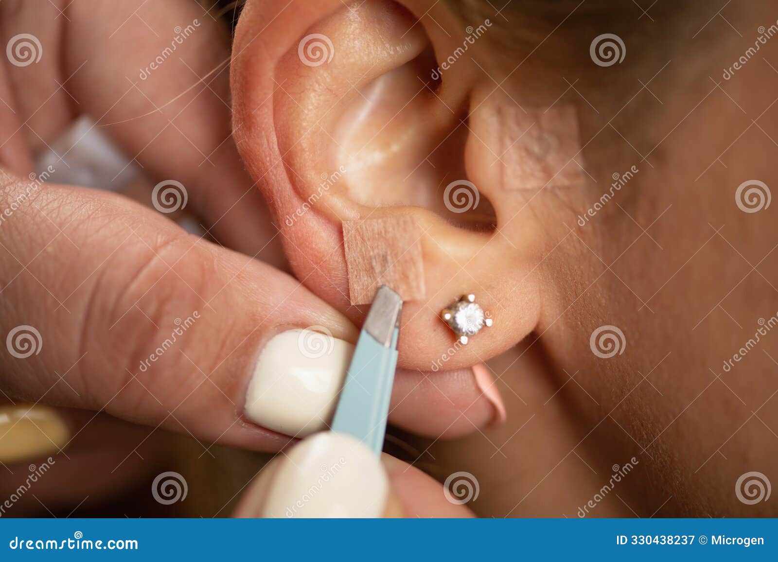 Auriculotherapy Stimulates Pressure Points on the Ear Stock Image ...