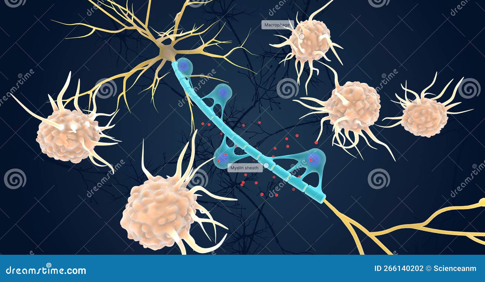 Autoimmune Attack on Myelin Sheath Stock Illustration - Illustration of ...