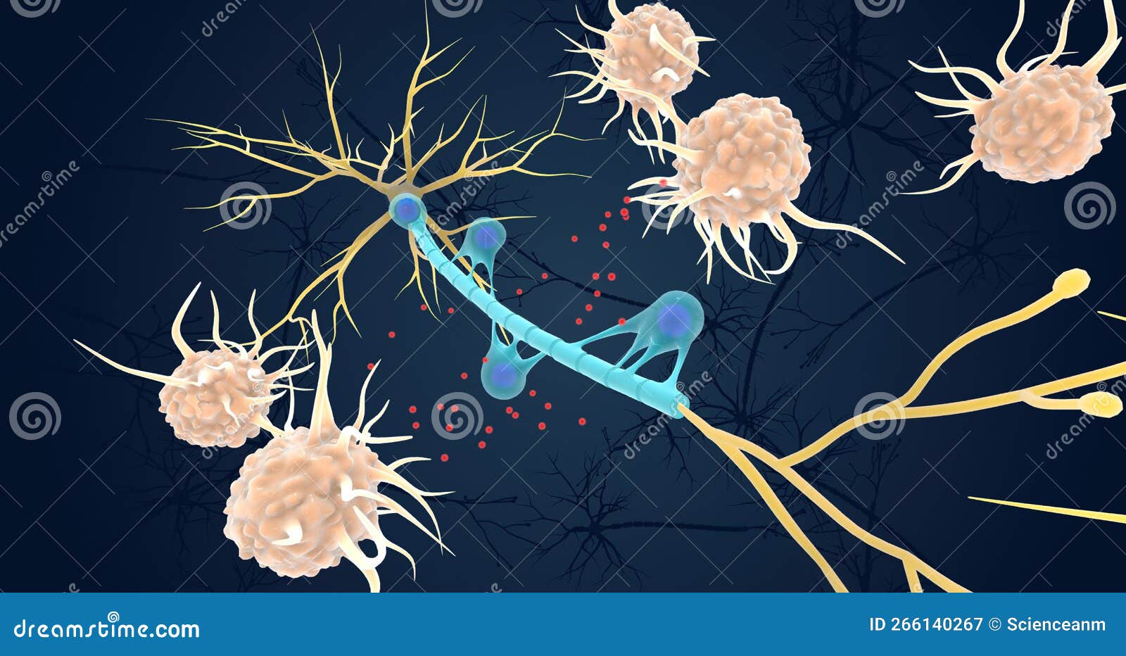 Autoimmune Attack on Myelin Sheath Stock Illustration - Illustration of ...