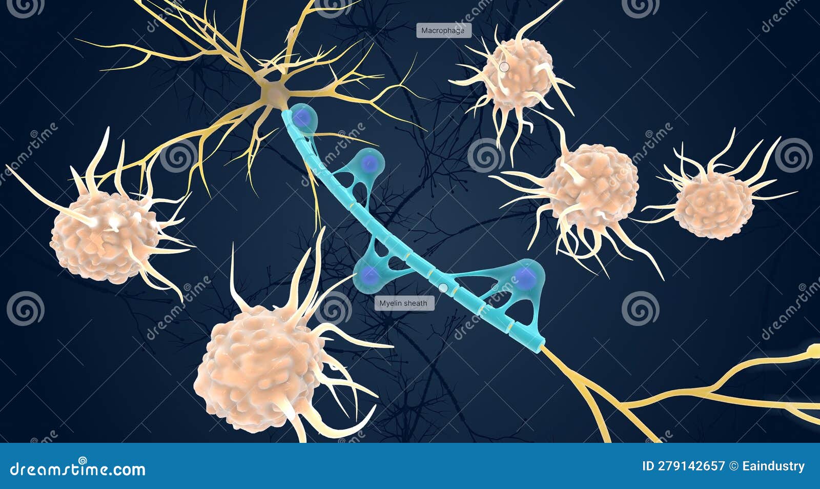 Autoimmune Attack On Myelin Sheath Royalty-Free Stock Photography ...