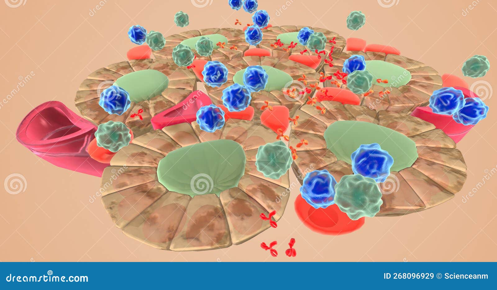 Autoimmune Attack on Thyroid Cells Stock Illustration - Illustration of ...