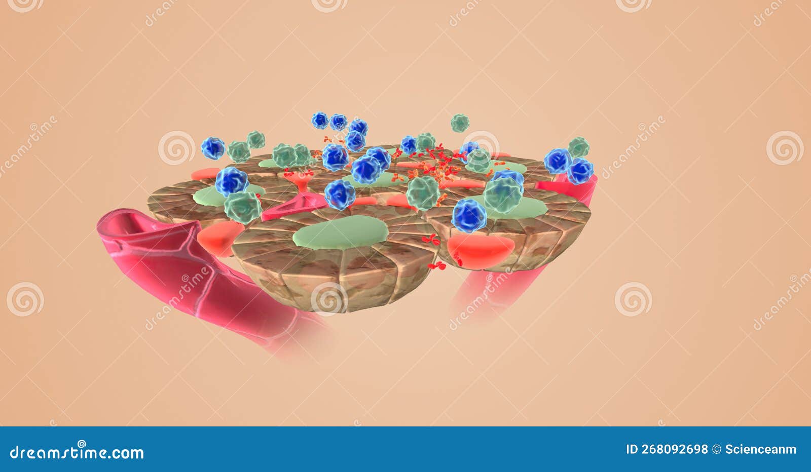 Autoimmune Attack on Thyroid Cells Stock Illustration - Illustration of ...