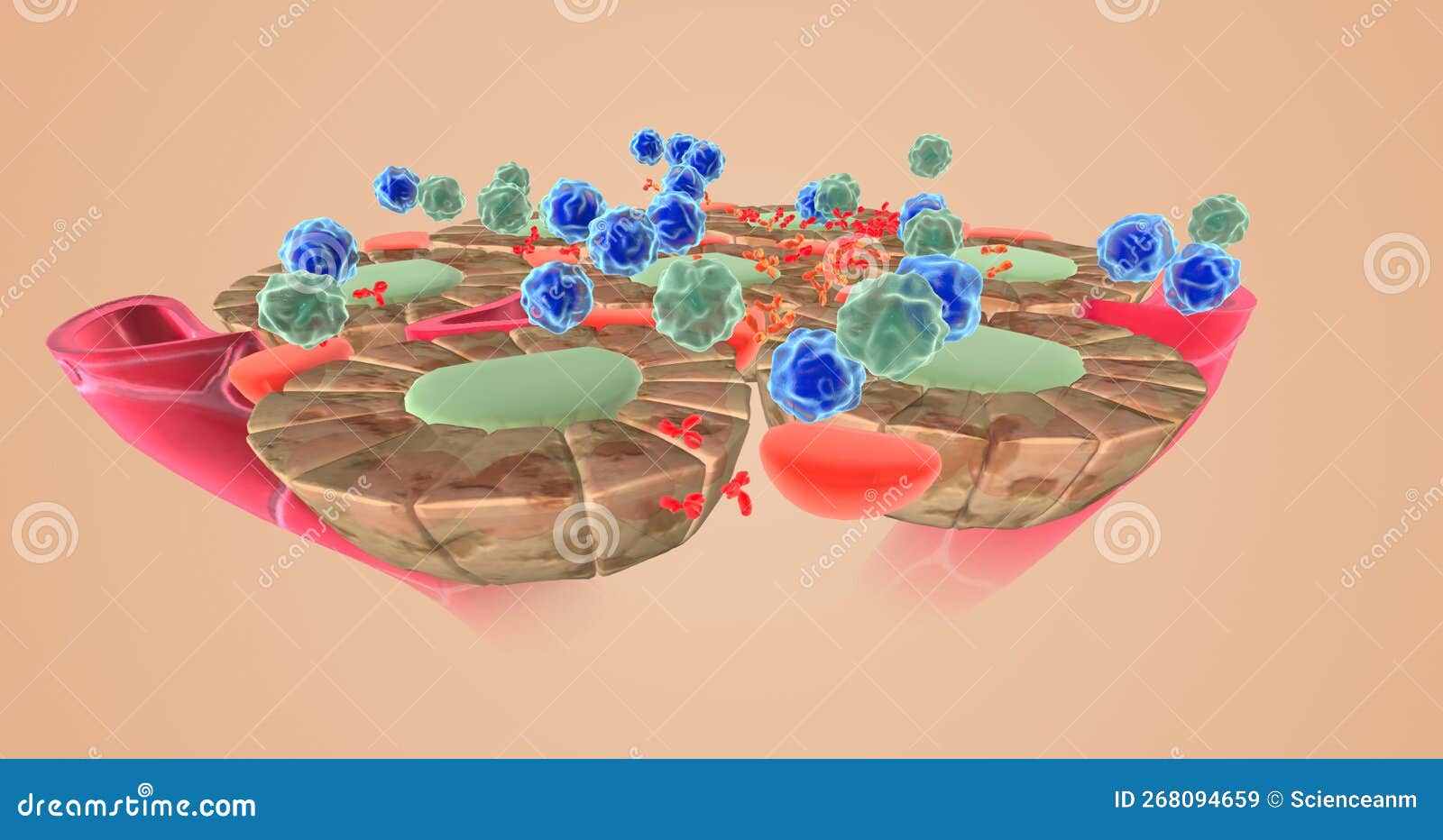 Autoimmune Attack on Thyroid Cells Stock Illustration - Illustration of ...