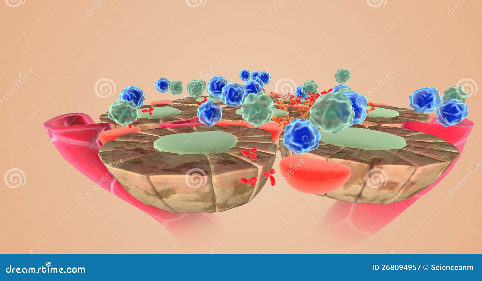Autoimmune Attack on Thyroid Cells Stock Illustration - Illustration of ...