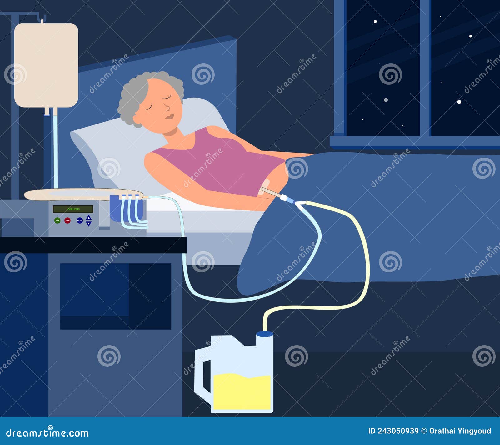 Automated Peritoneal Dialysis at Night. Stock Vector - Illustration of ...