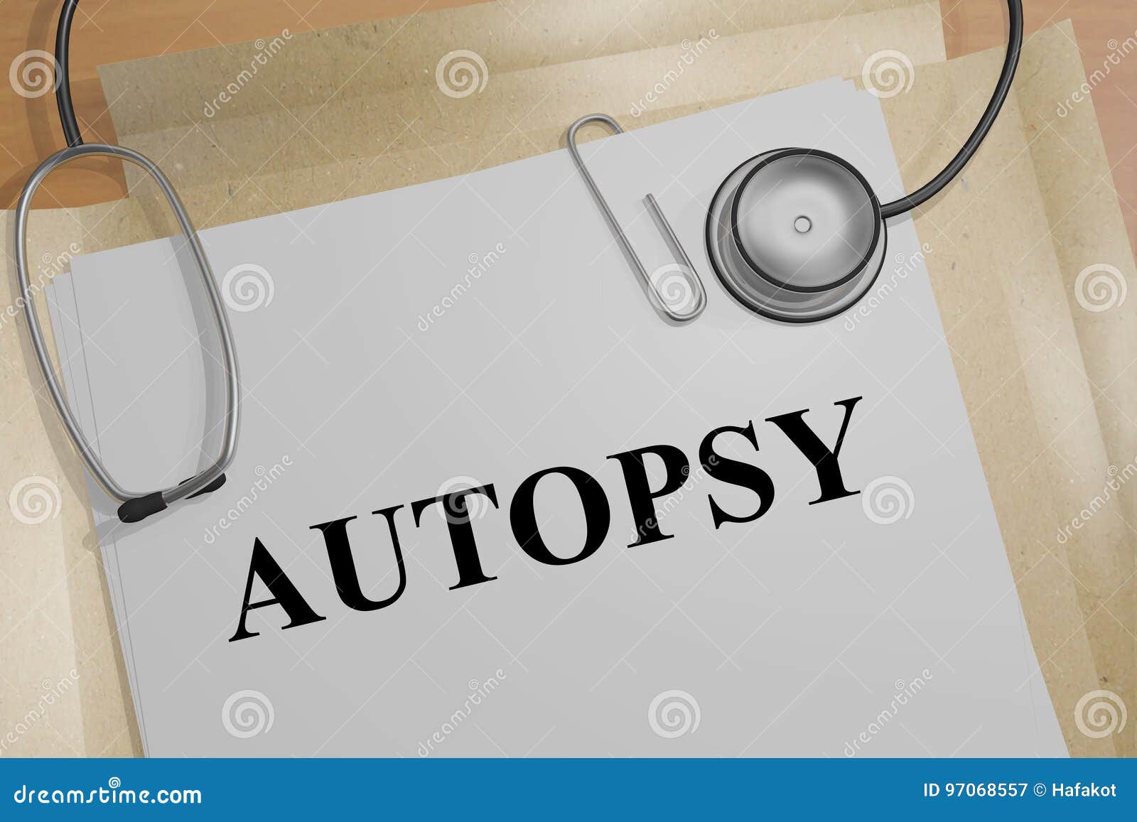 Autopsy - medical concept stock illustration. Illustration of murder ...