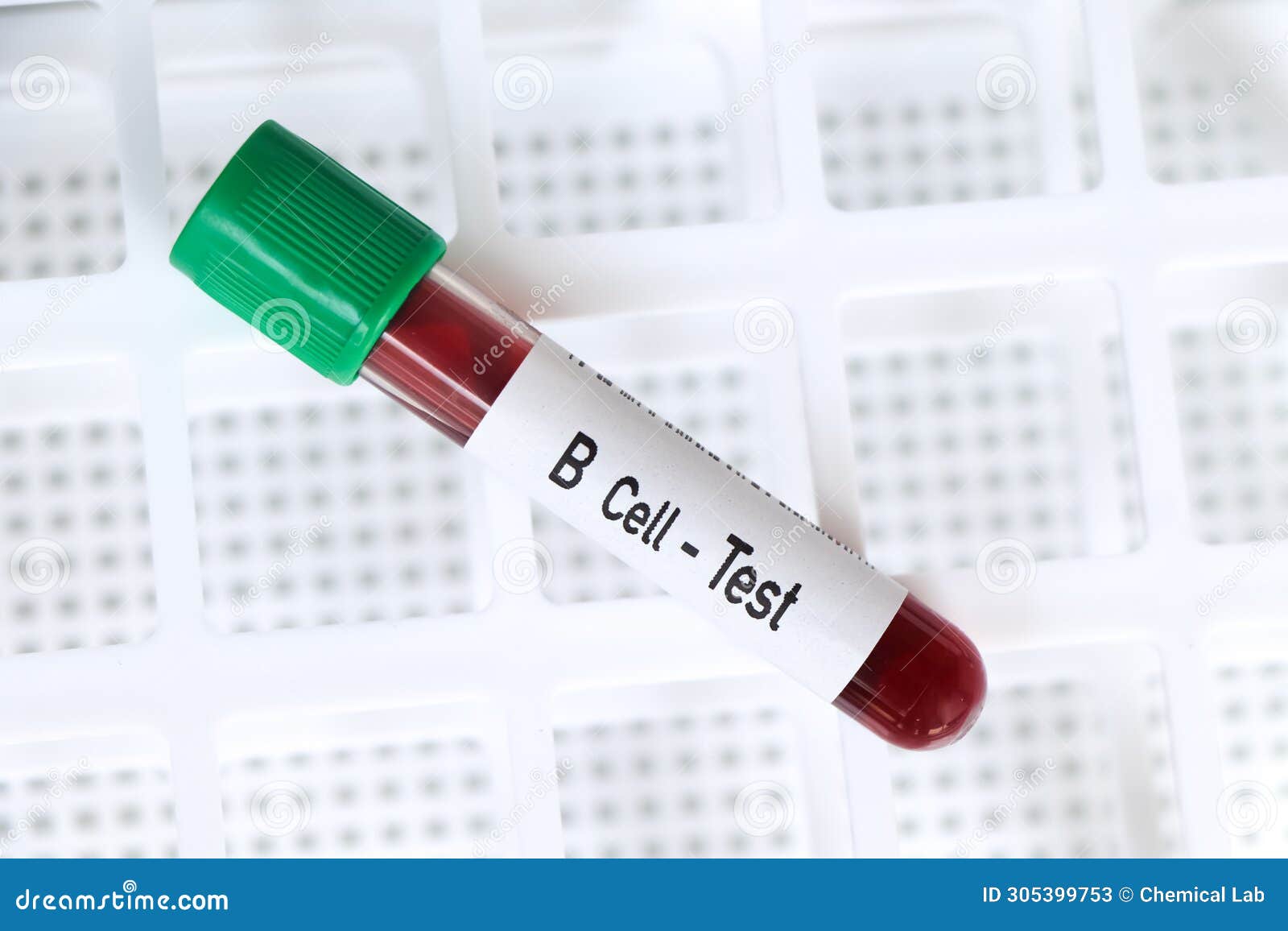 B Cell Test, Blood Sample To Analyze in the Laboratory Stock Image ...