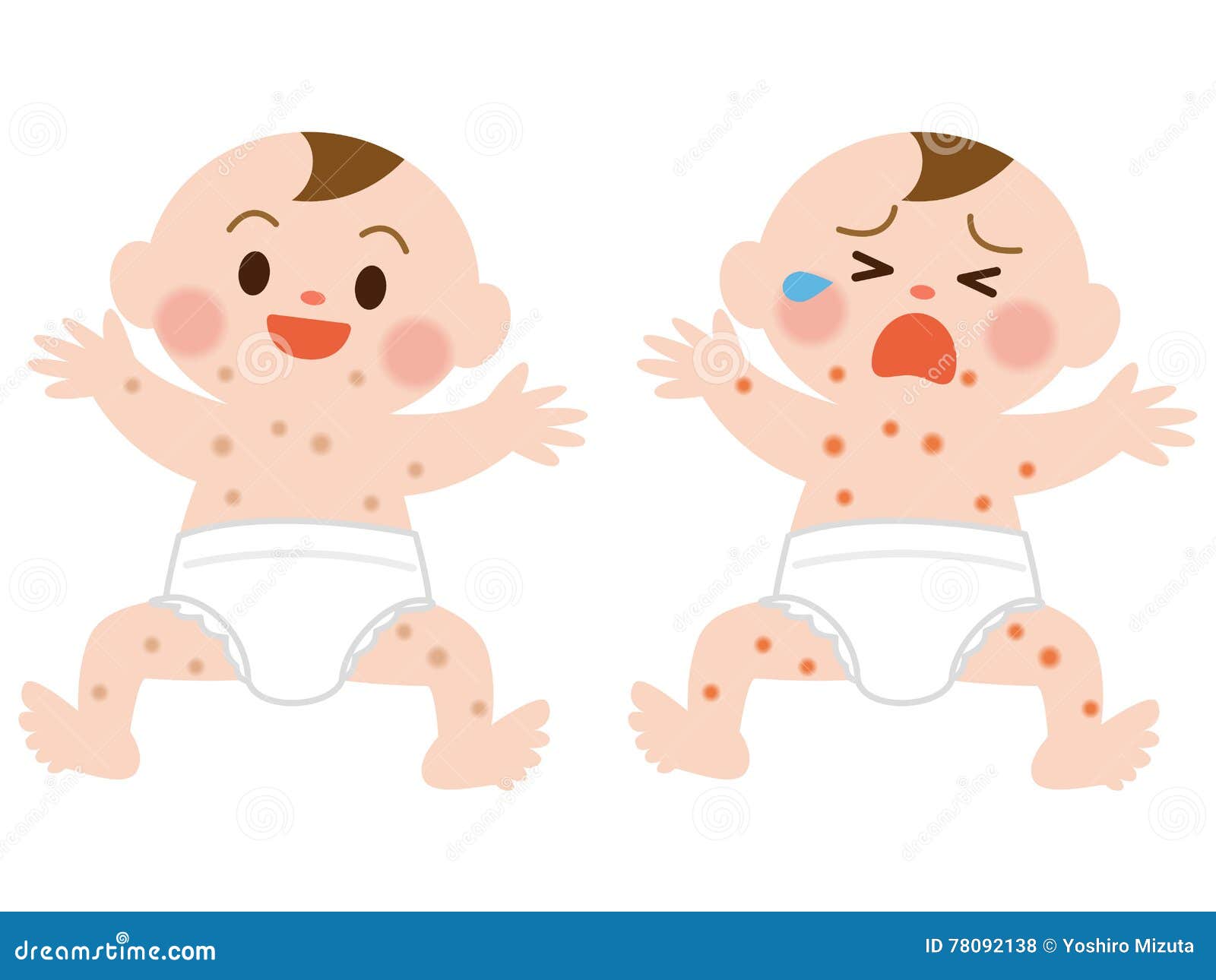 Cartoon Skin Irritation