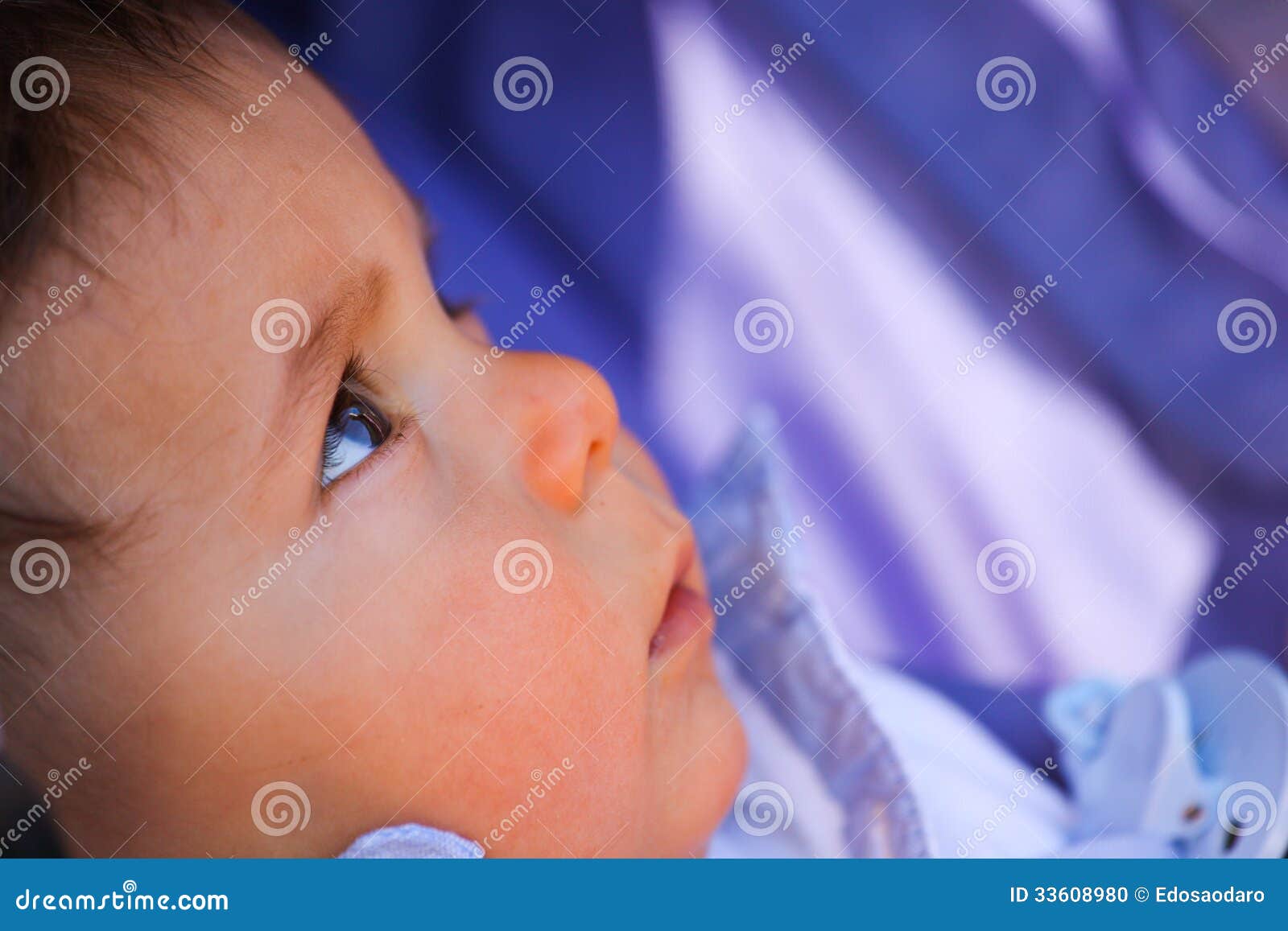 A Baby With Eyes Full Of Rheum, Produced By Conjunctivitis ...