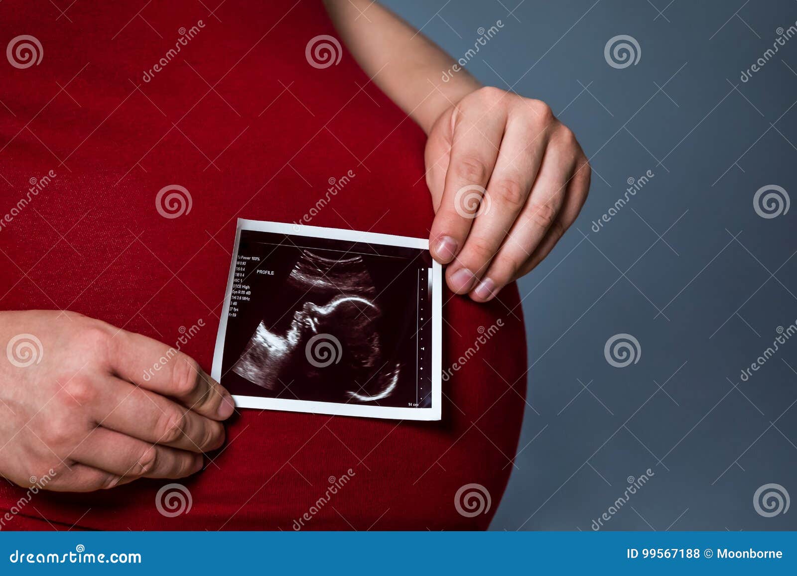 Baby Ready stock photo. Image of birth, happy, belly - 99567188