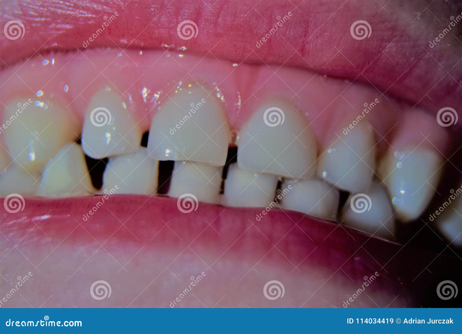 Baby`s Milk Teeth in a Large Approximation Stock Image - Image of ...