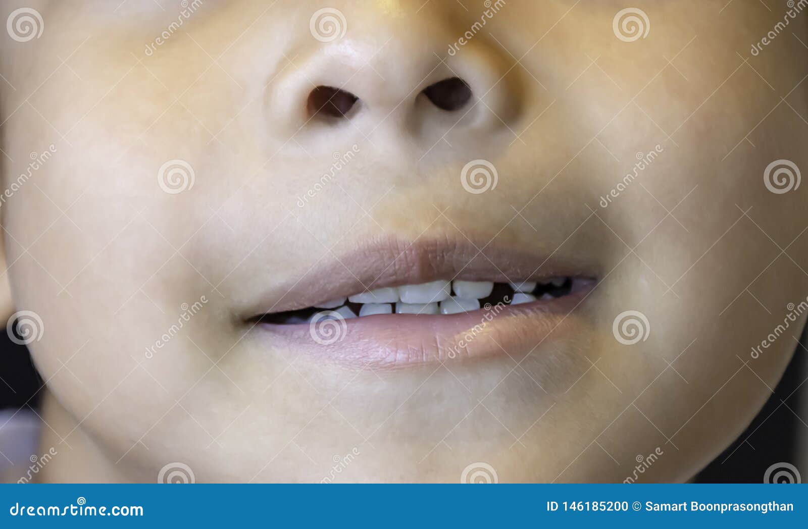 Baby Teeth are Just Dropped in the Mouth Stock Photo - Image of front ...