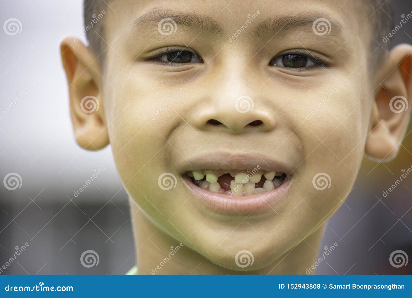 Baby Teeth are Just Dropped in the Mouth Stock Photo - Image of closeup ...