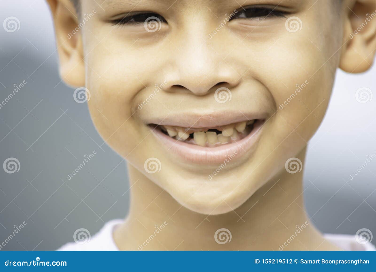 Baby Teeth are Just Dropped in the Mouth Stock Photo - Image of milk ...