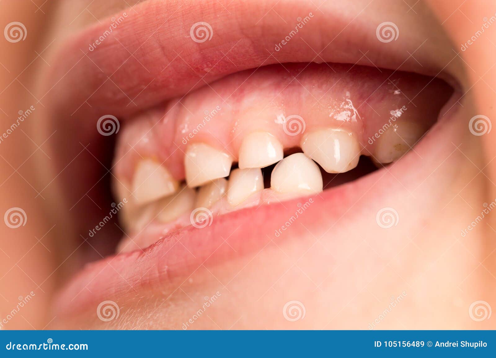 Baby teeth. macro stock image. Image of macro, teeth - 105156489