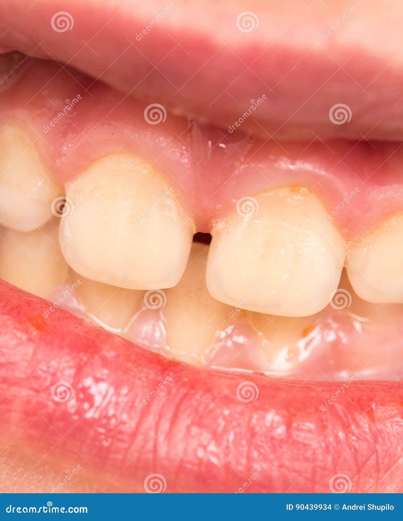 Baby teeth. macro stock photo. Image of dental, beauty - 90439934