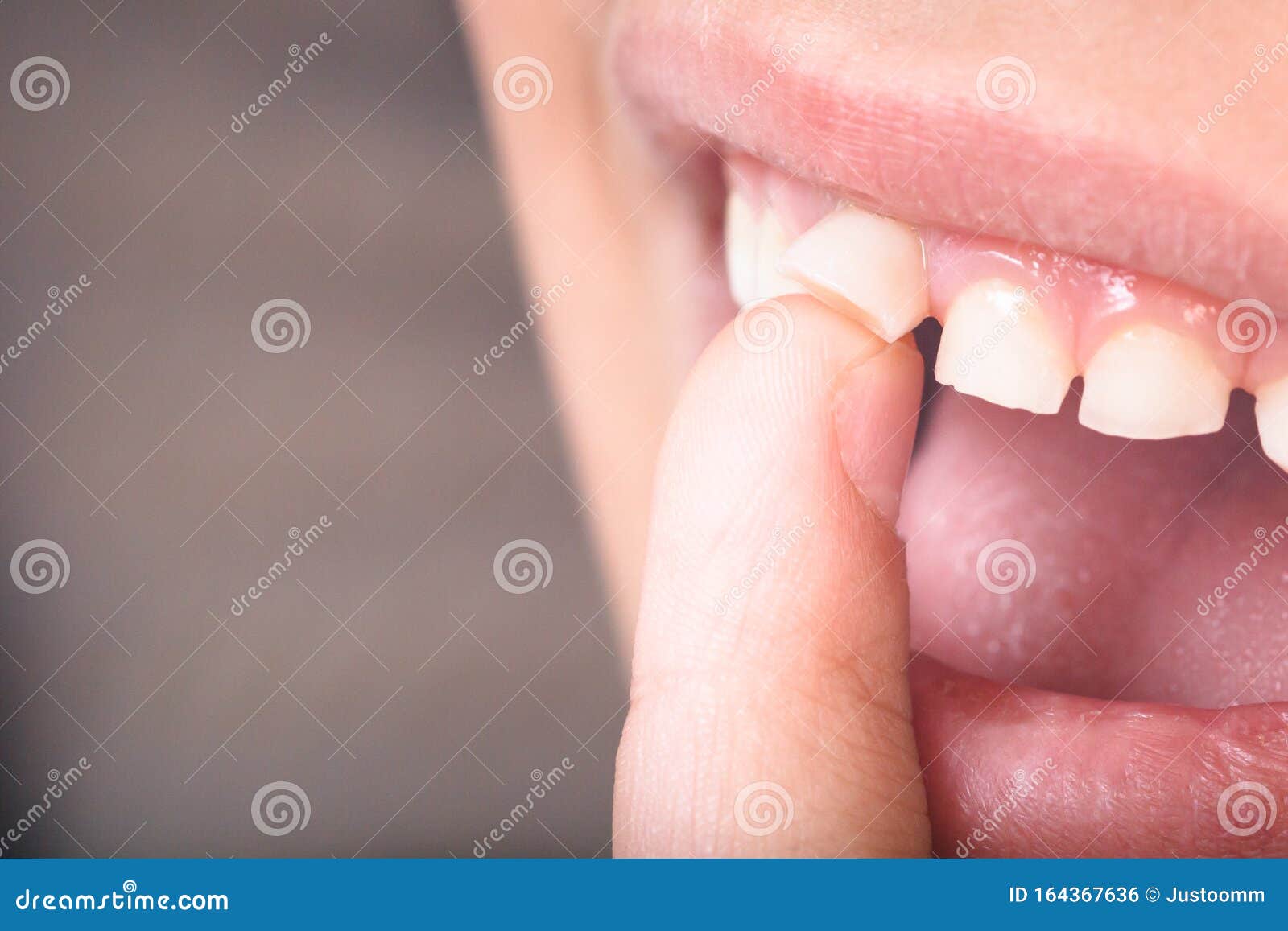 Baby Tooth, Close-up of the Tooth that Falls Macro Shot Stock Photo ...
