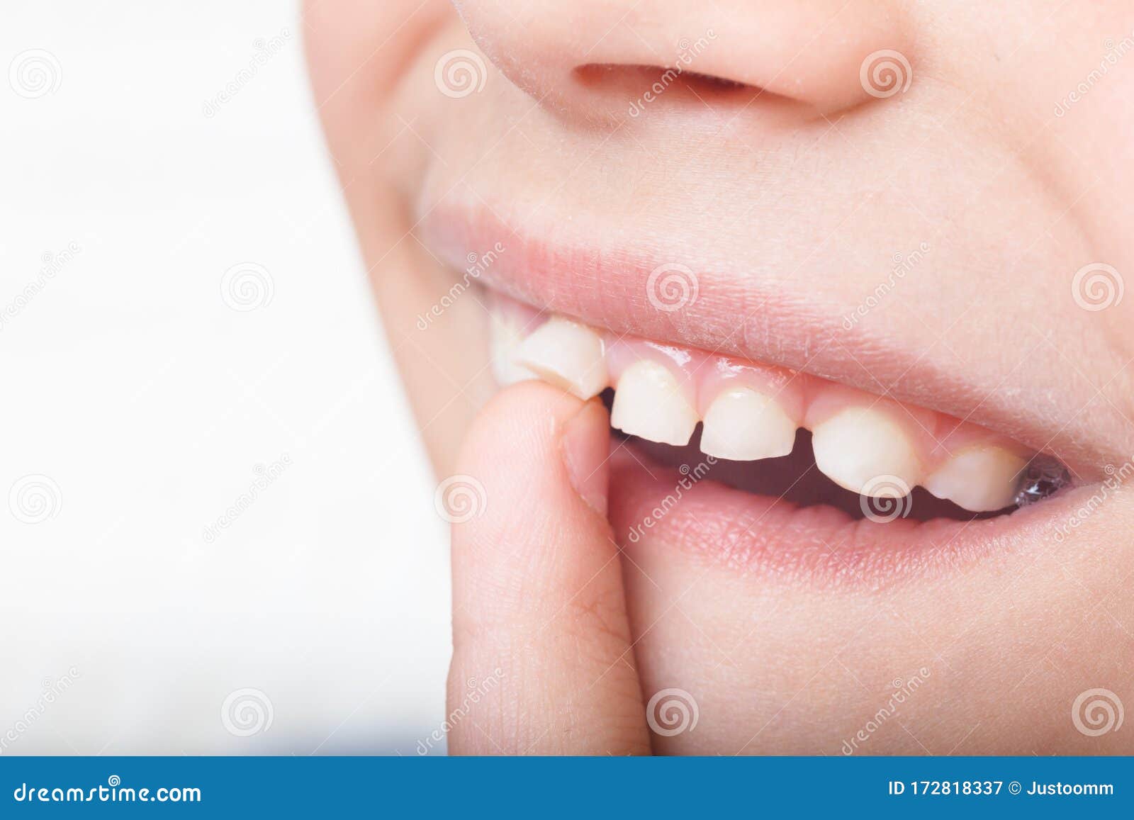 Baby Tooth, Close-up of the Tooth that Falls Macro Shot Stock Image ...