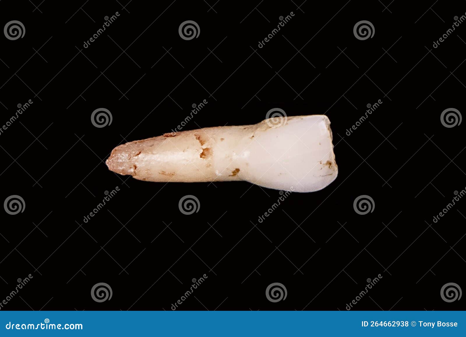 Baby Tooth with Root, Isolated Stock Photo - Image of wellness, health ...