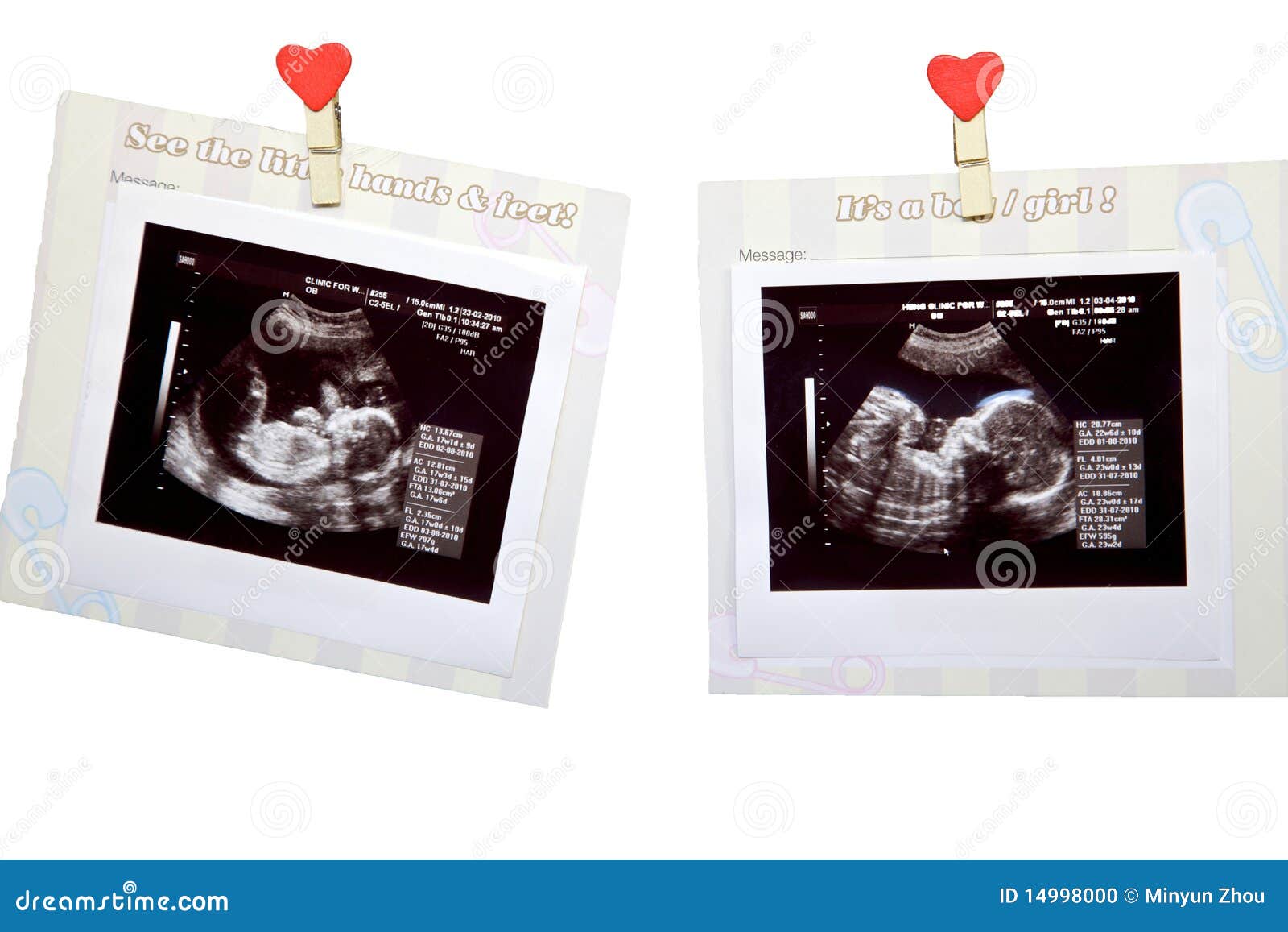 Baby ultrasound stock photo. Image of graphic, girl, care - 14998000