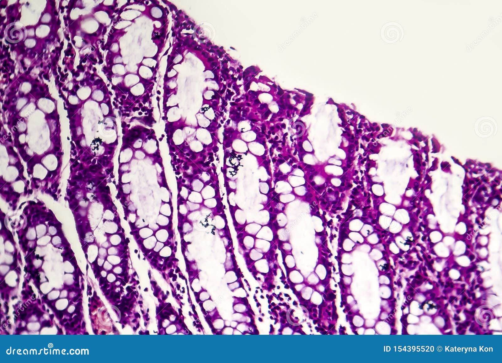 Bacillary Dysentery, Light Micrograph Stock Photo - Image of ...