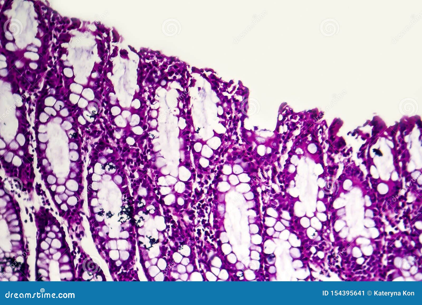 Bacillary Dysentery, Light Micrograph Stock Image - Image of ...