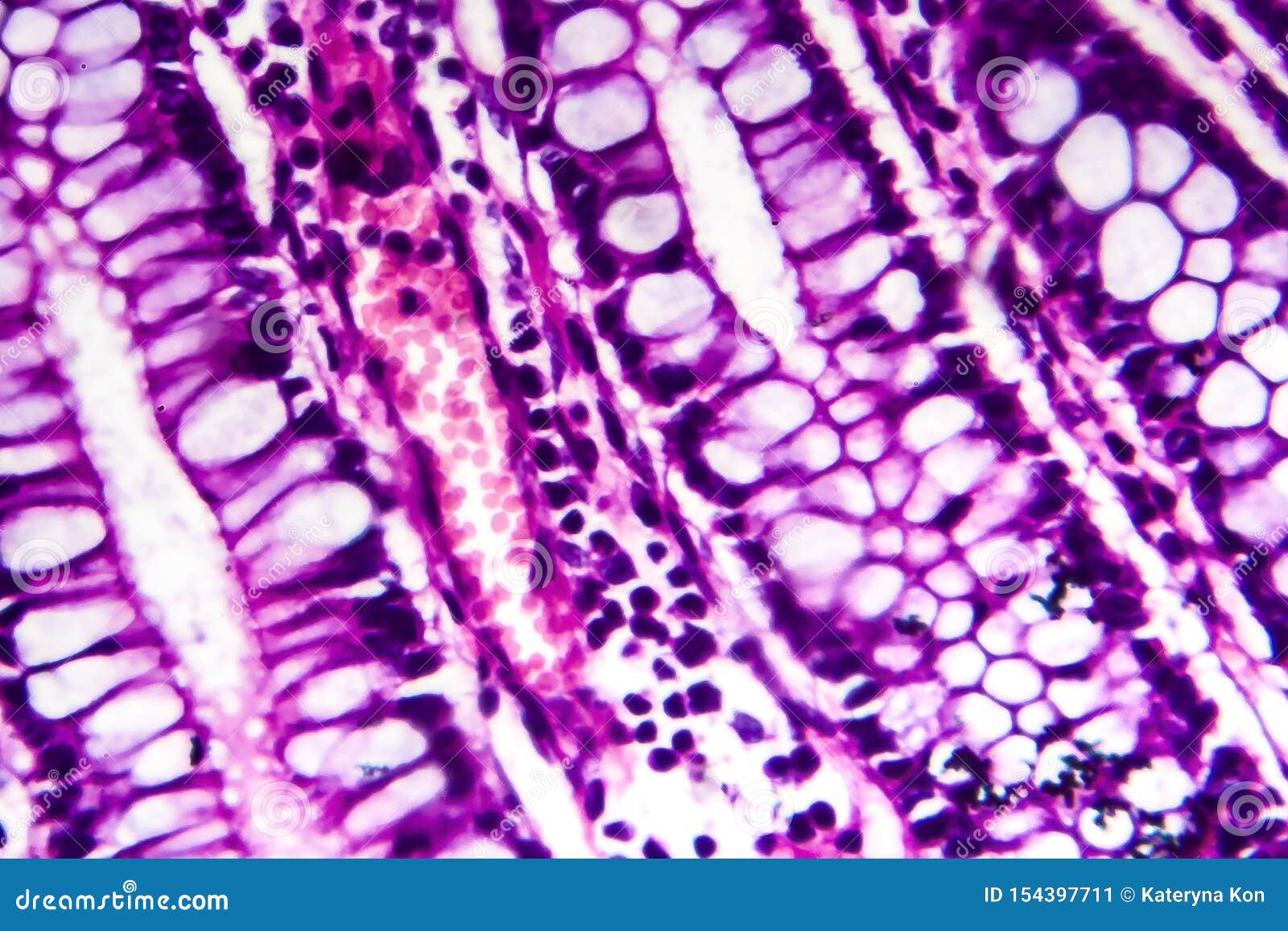 Bacillary Dysentery, Light Micrograph Stock Image - Image of ...