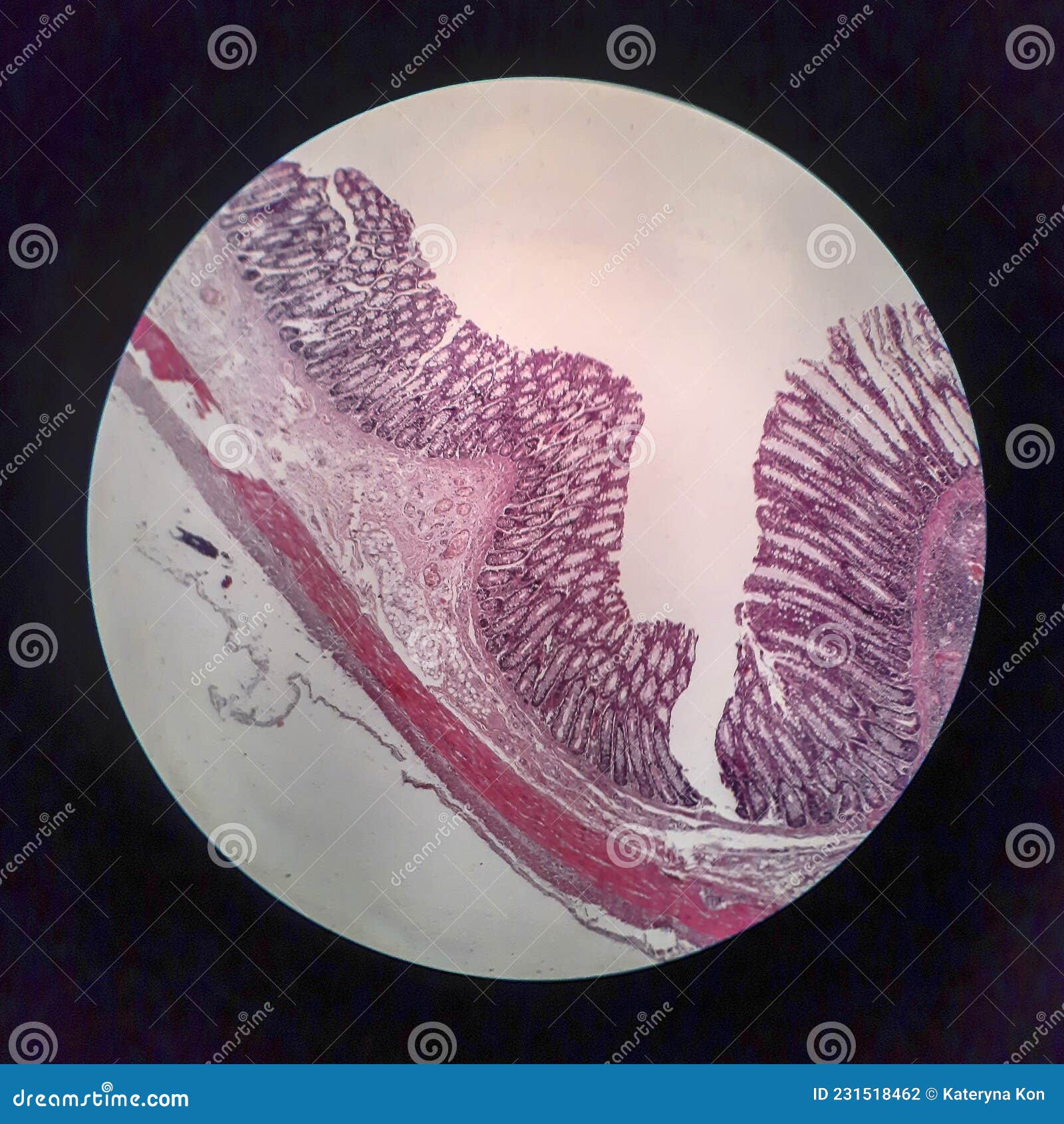 Bacillary Dysentery, Light Micrograph Stock Photo - Image of ...
