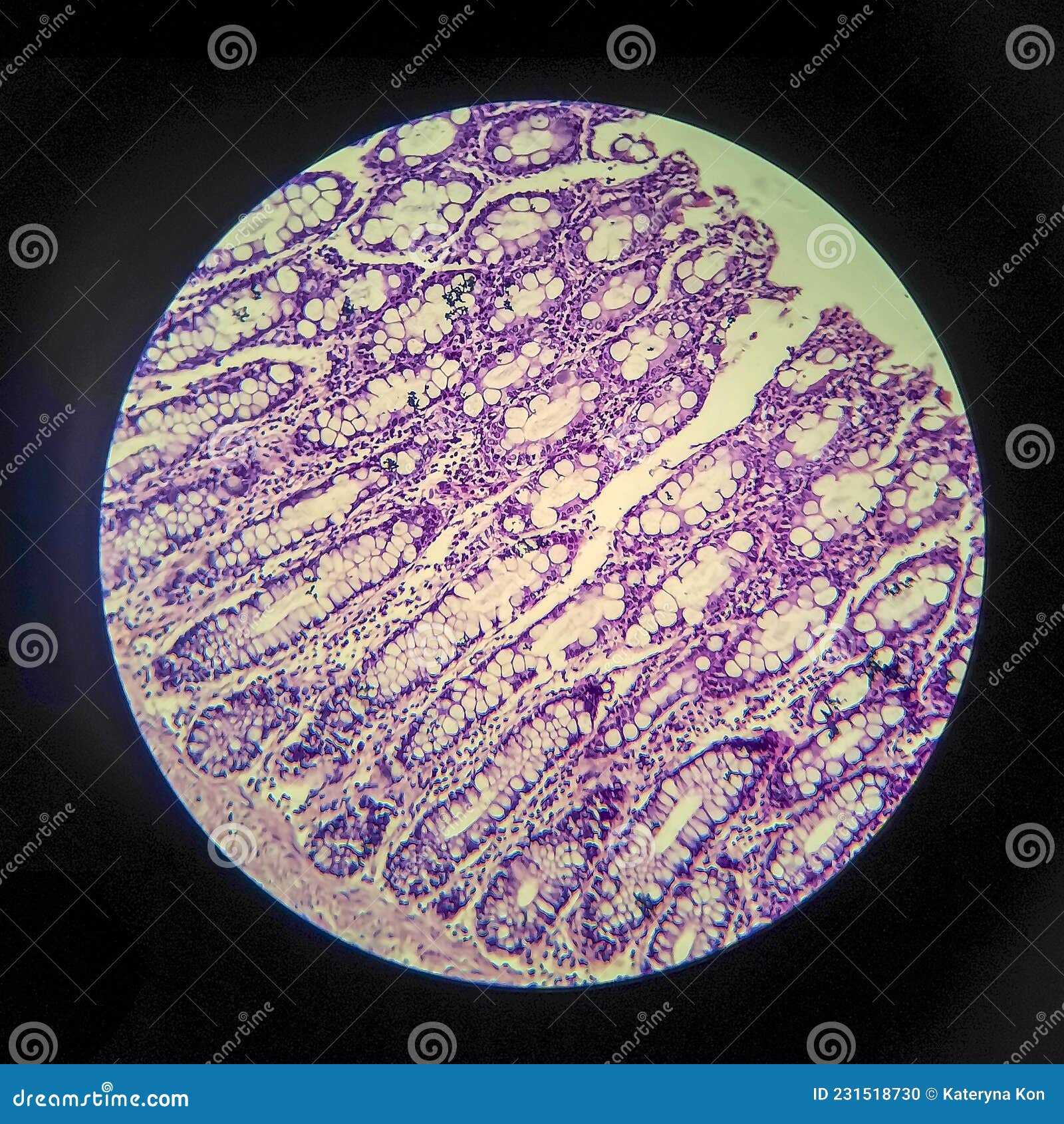 Bacillary Dysentery, Light Micrograph Royalty-Free Stock Photo ...