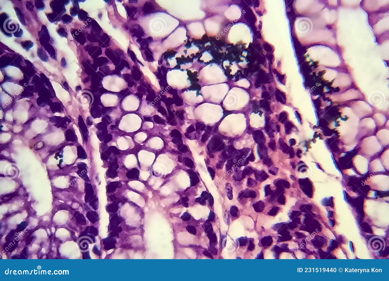 Bacillary Dysentery, Light Micrograph Stock Photo - Image of bacterium ...