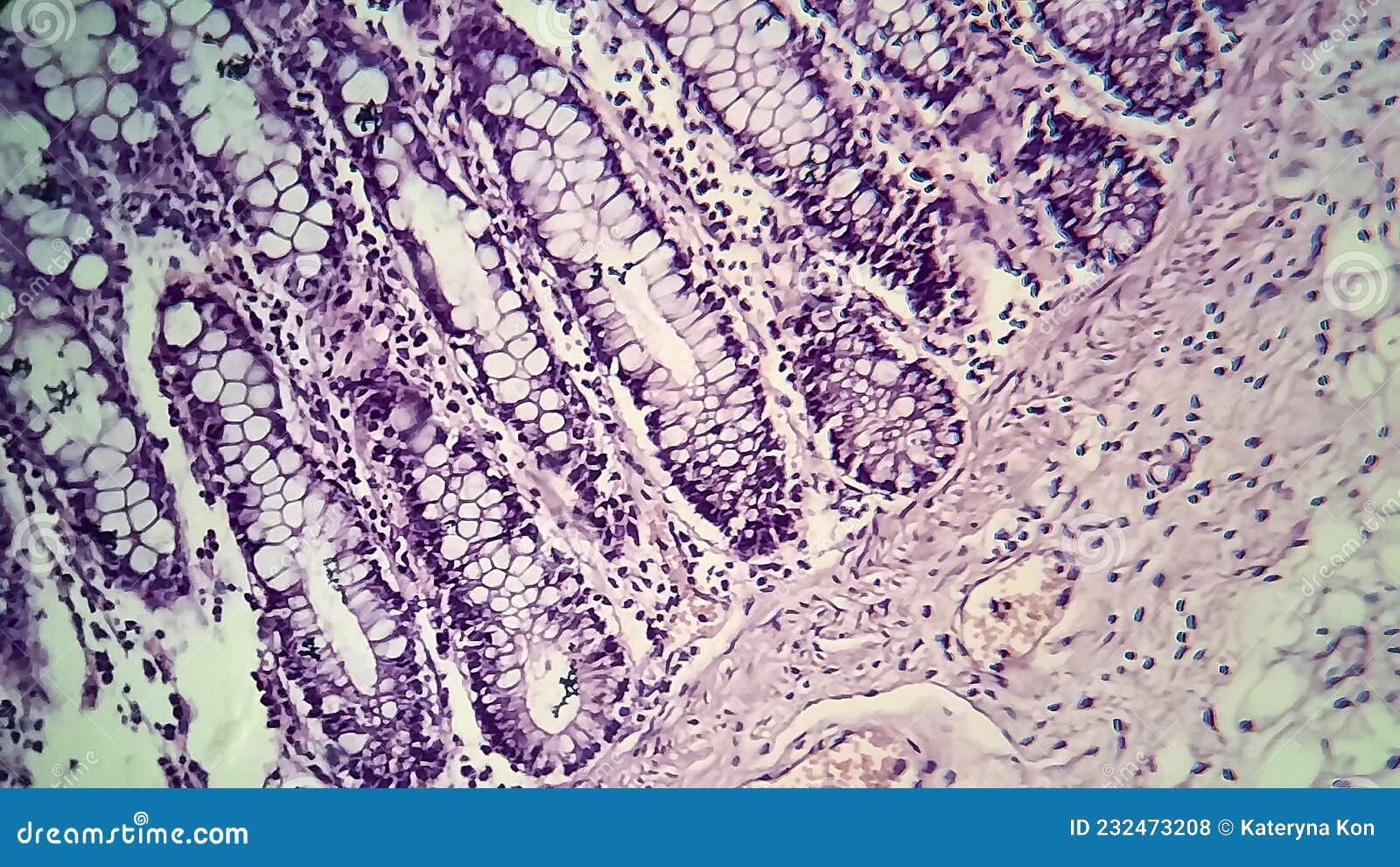 Intestinal Epithelium. Brush Border Stock Image | CartoonDealer.com ...