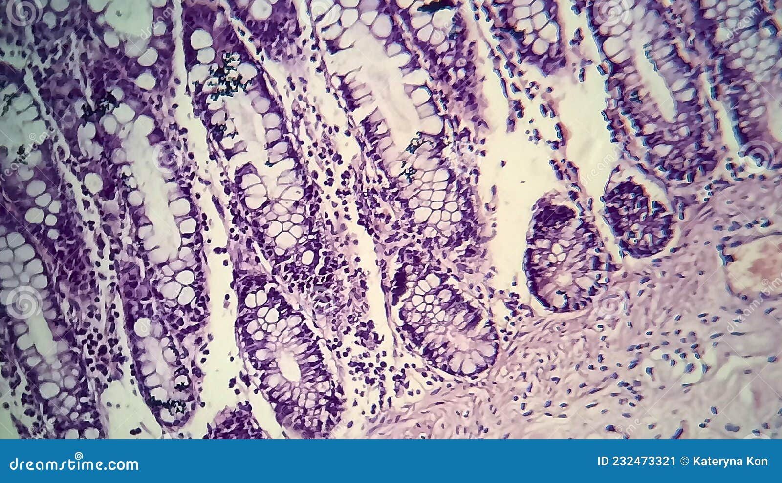 Bacteria Under Light Microscope